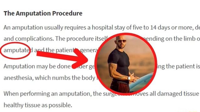 The Amputation Procedure An amputation usually requires a hospital stay ...