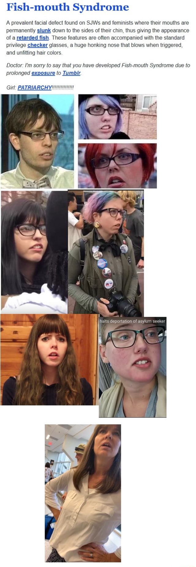 Fish-mouth Syndrome A prevalent facial defect found on SJWs and ...