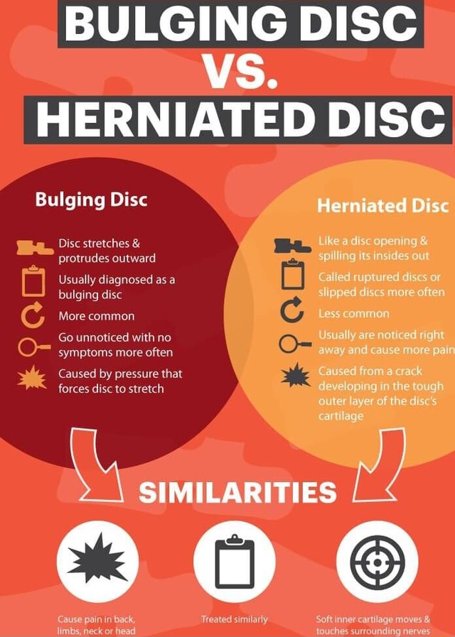 BULGING DISC VS. HERNIATED DISC Bulging Disc Disc stretches & protrudes ...