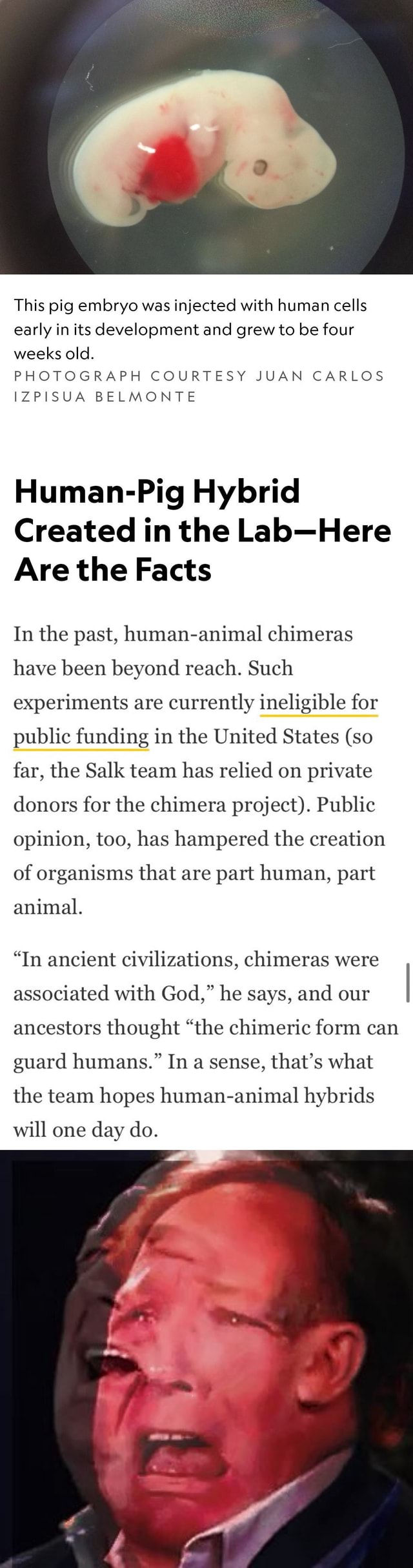 This pig embryo was injected with human cells early in its development ...