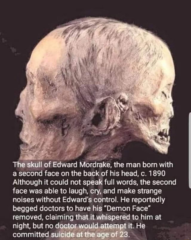 He skull of Edward Mordrake, the man born with a second face on the ...