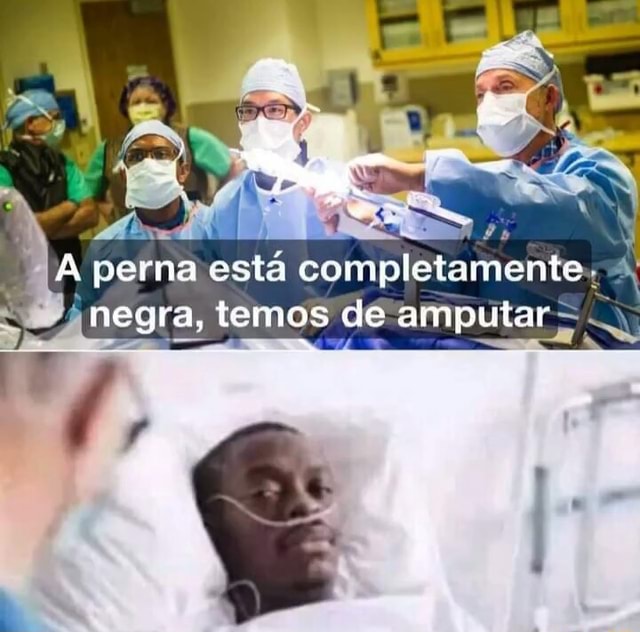 Perna está completamente negra, temos de amputar - iFunny Brazil