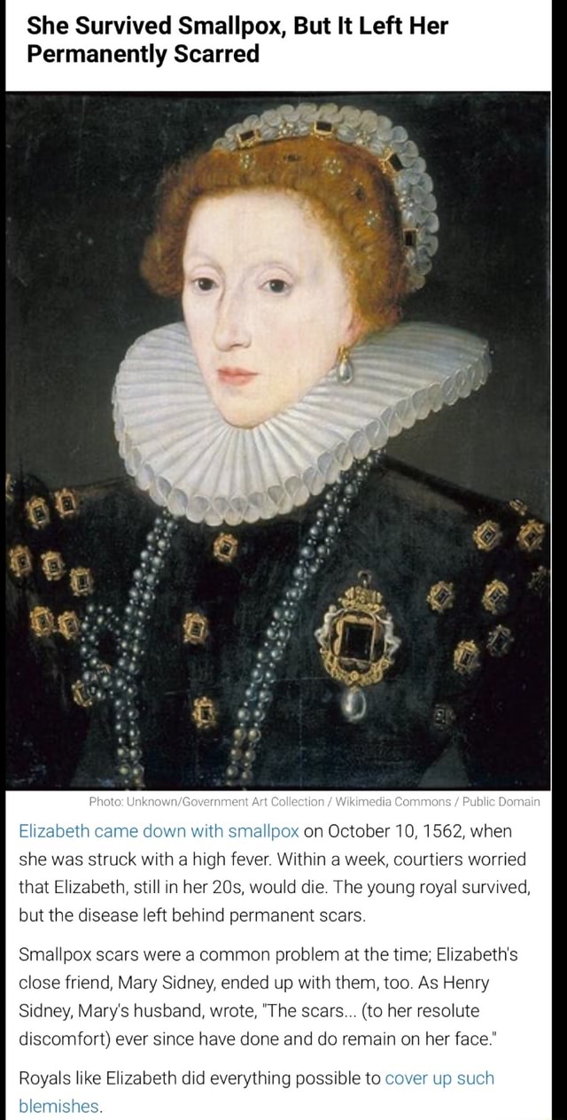 She Survived Smallpox, But It Left Her Permanently Scarred Pu Elizabeth ...