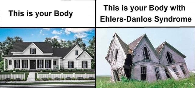 Chronic illness memes - This is your Body with This is your Body Ehlers ...