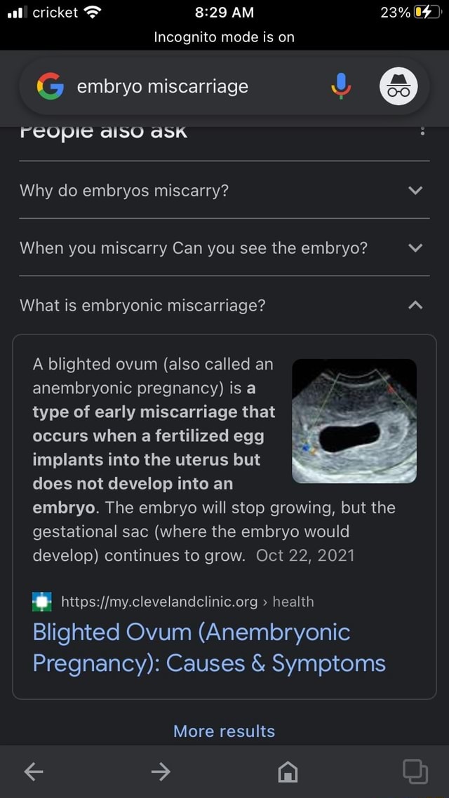 Al) cricket AM 23% Incognito mode is on G embryo miscarriage reopie ...