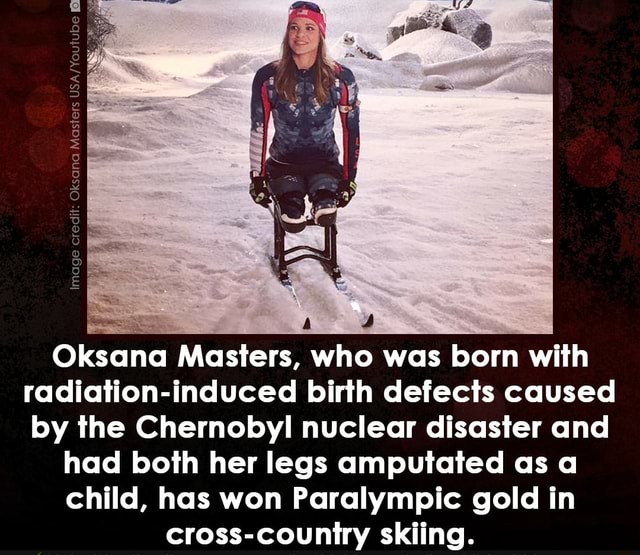 Oksana Masters, who was born with radiation-induced birth defects ...