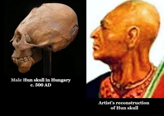 Male Hun skull in Hungary 500 AD Artist's reconstruction of Hun skull ...
