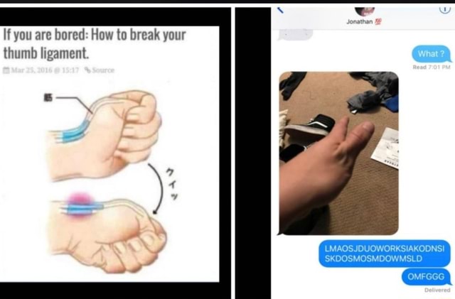 If you are bored: How to break your thumb ligament ...